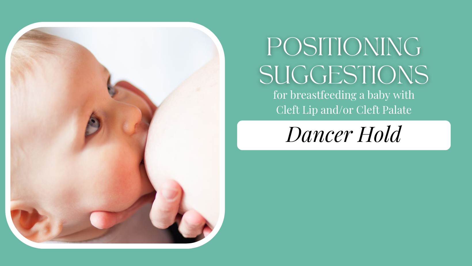 Feeding a Baby with a Cleft Lip and/or Cleft Palate | La Leche League ...